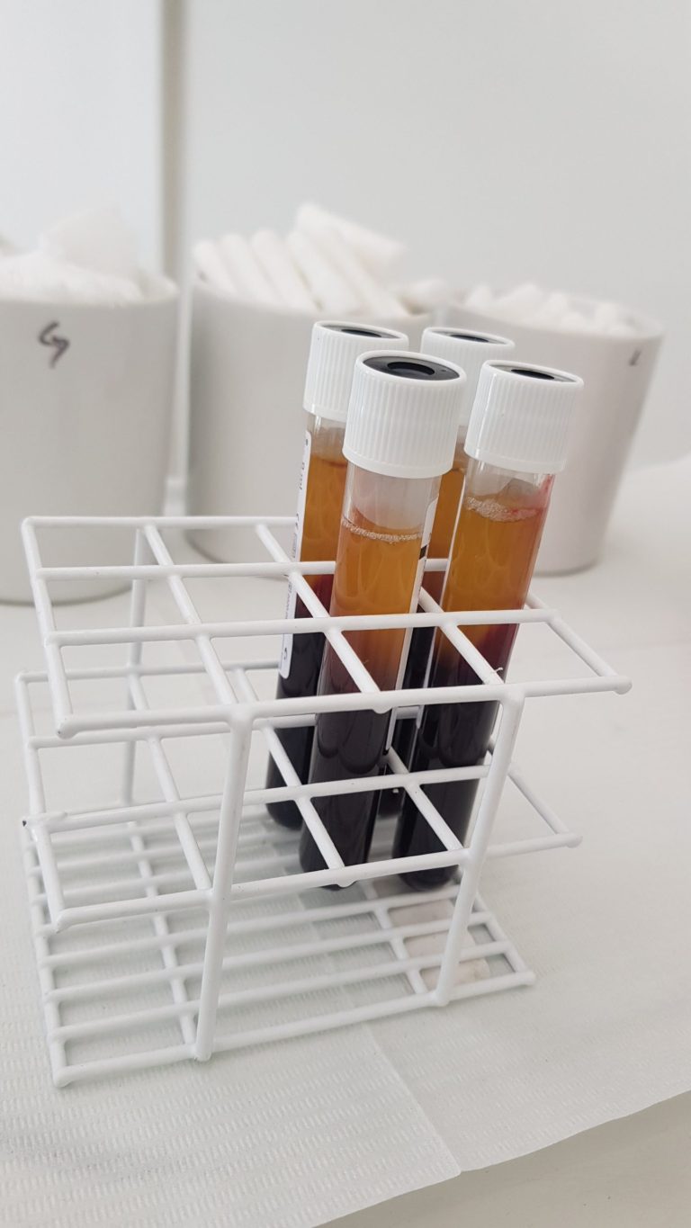 PRF Fibrina Rica em Plaquetas – Duallis